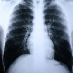 Clear Choice Performance X-Ray Film Clear Choice Performance 10 X 12 ...