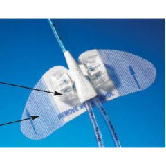 Statlock PICC Plus Catheter / Line Securement Device StatLock PICC Plus ...